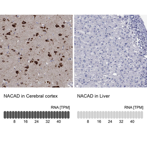 Rabbit Polyclonal Anti-NACAD Antibody - Buy for research - Highly ...