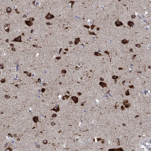 Anti-NACAD Human Protein Atlas Antibody