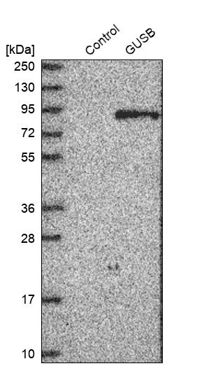Rabbit Polyclonal Anti-GUSB Antibody - Buy for research - Highly ...