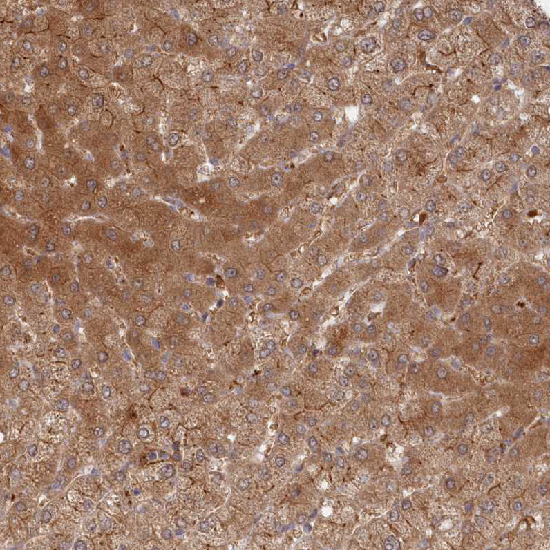 Rabbit Polyclonal Anti-ABHD14B Antibody - Buy for research - Highly ...