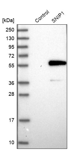 Rabbit Polyclonal Anti-SNIP1 Antibody - Buy for research - Highly ...