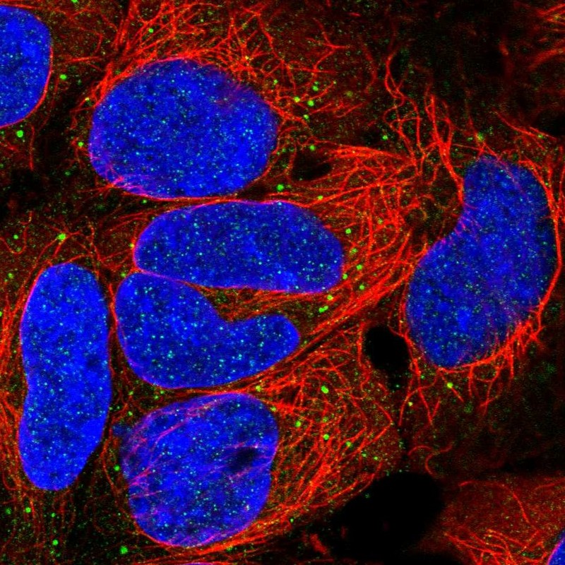 Rabbit Polyclonal Anti-EDA Antibody - Buy for research - Highly ...