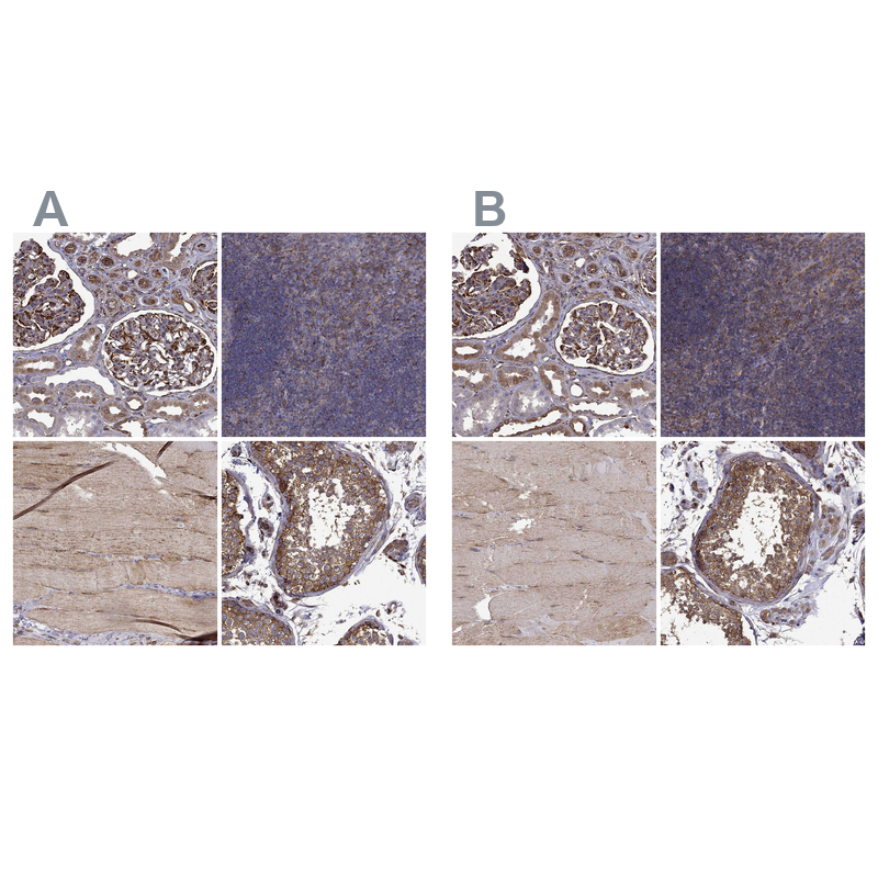 Rabbit Polyclonal Anti-MAP4 Antibody - Buy for research - Highly ...