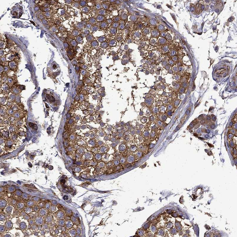 Rabbit Polyclonal Anti-MAP4 Antibody - Buy for research - Highly ...