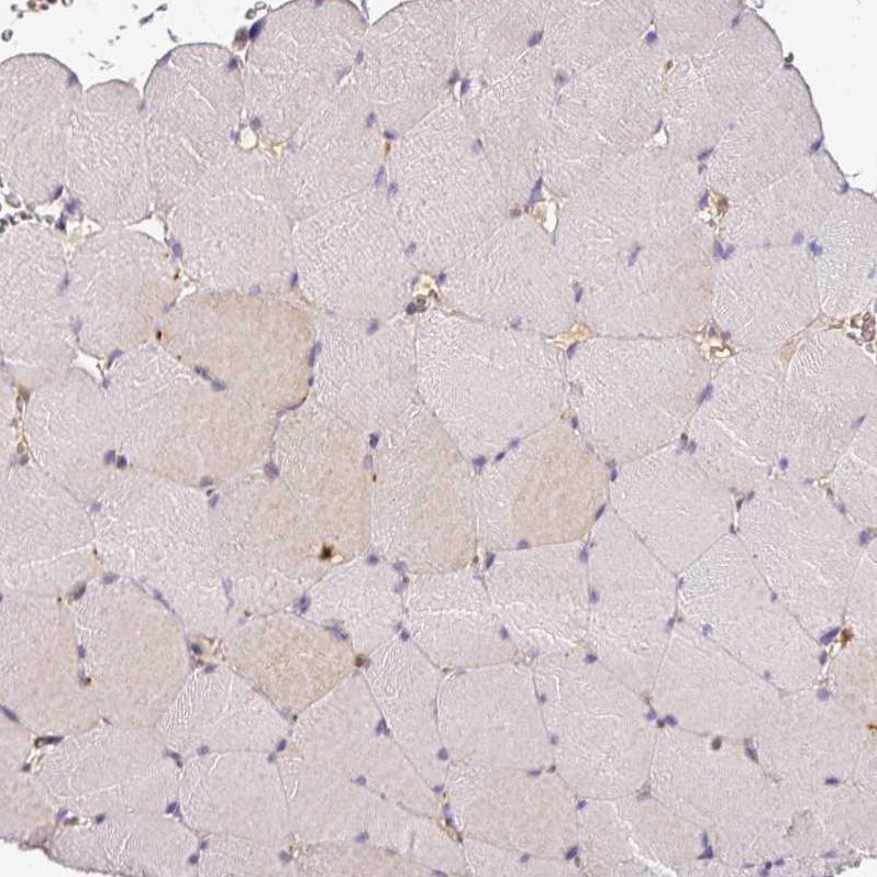 Rabbit Polyclonal Anti-ADH5 Antibody - Buy for research - Highly ...