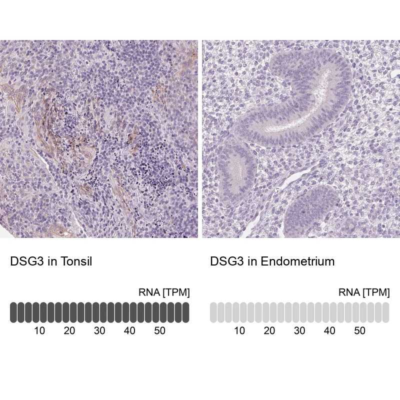 Rabbit Polyclonal Anti-DSG3 Antibody - Buy for research - Highly ...