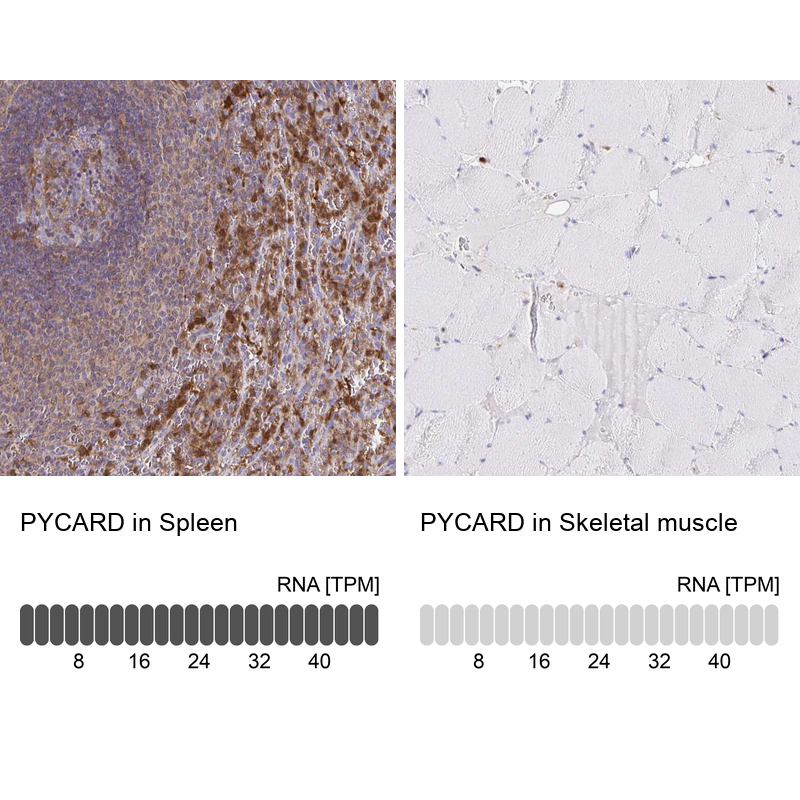 Rabbit Polyclonal Anti-PYCARD Antibody - Buy for research - Highly ...