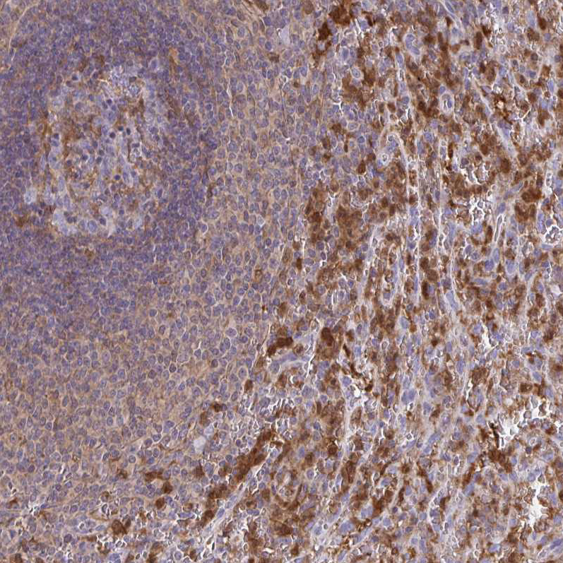 Rabbit Polyclonal Anti-PYCARD Antibody - Buy for research - Highly ...