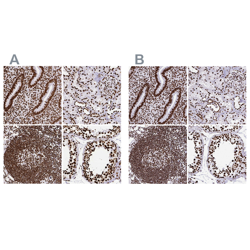 Rabbit Polyclonal Anti-SFPQ Antibody - Buy for research - Highly ...