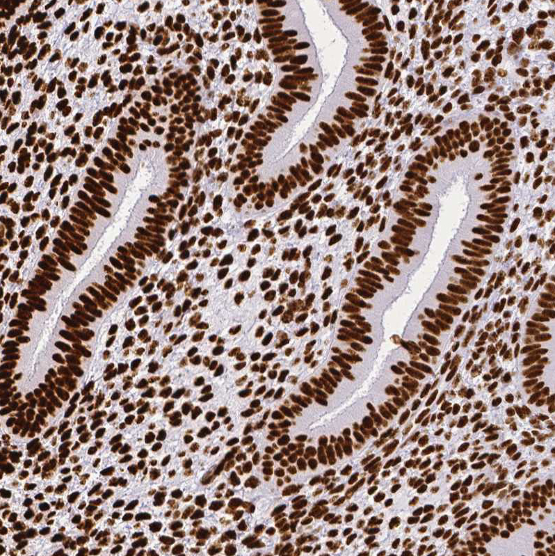 Rabbit Polyclonal Anti-SFPQ Antibody - Buy for research - Highly ...