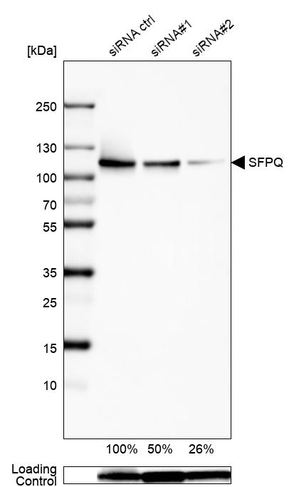 Rabbit Polyclonal Anti-SFPQ Antibody - Buy for research - Highly ...