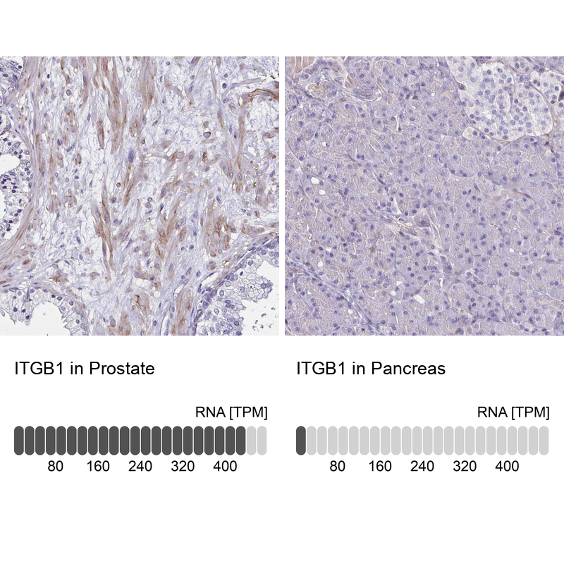 Rabbit Polyclonal Anti-ITGB1 Antibody - Buy for research - Highly ...