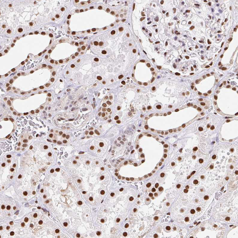 Rabbit Polyclonal Anti-SET Antibody - Buy for research - Highly ...
