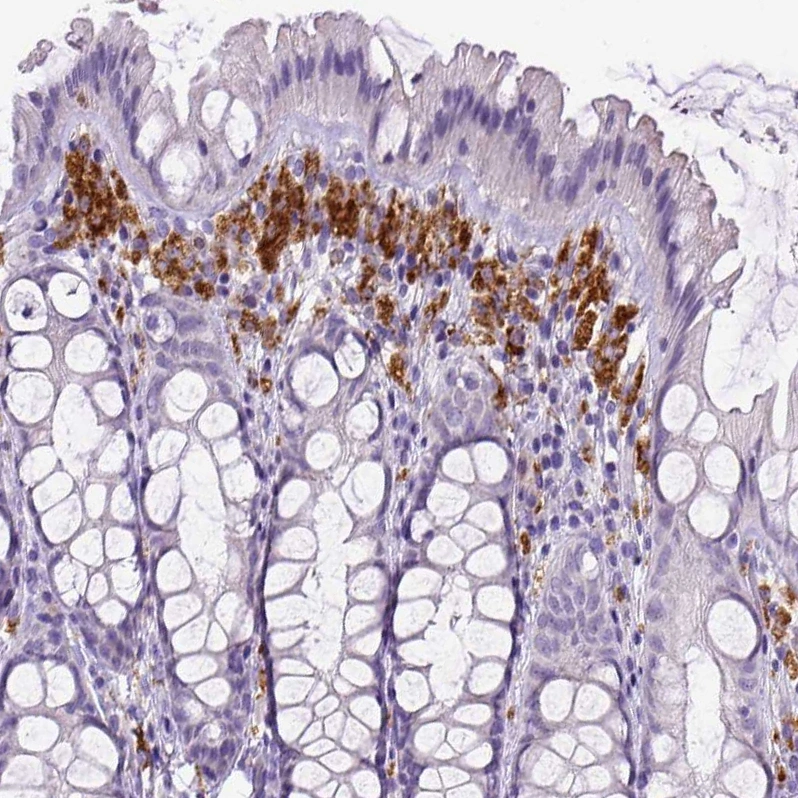 Mouse Monoclonal Anti-CD68 Antibody - Buy for research - Highly ...