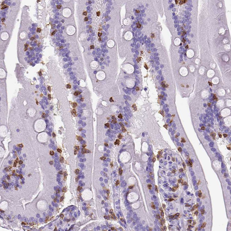 Mouse Monoclonal Anti-CD3E Antibody - Buy for research - Highly ...