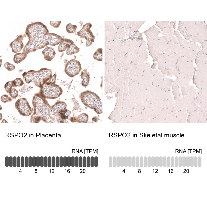 Mouse Monoclonal Anti-RSPO2 Antibody - Buy for research - Highly ...