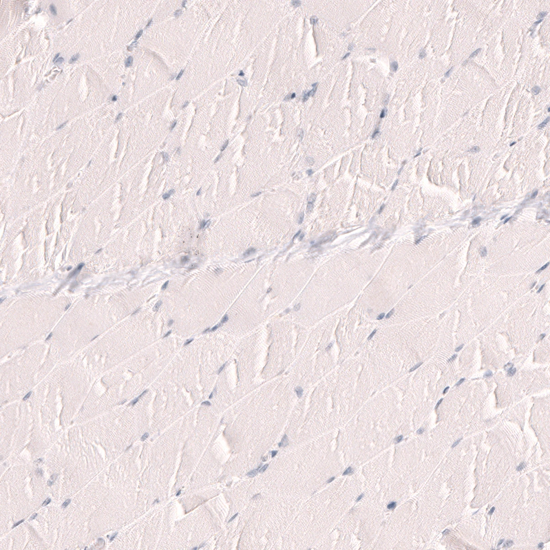 Mouse Monoclonal Anti-NKX2-1 Antibody - Buy for research - Highly ...