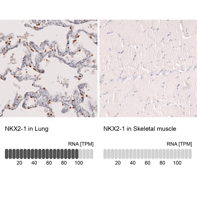 Mouse Monoclonal Anti-NKX2-1 Antibody - Buy for research - Highly ...