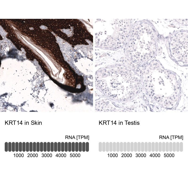 Mouse Monoclonal Anti-KRT14 Antibody - Buy for research - Highly ...