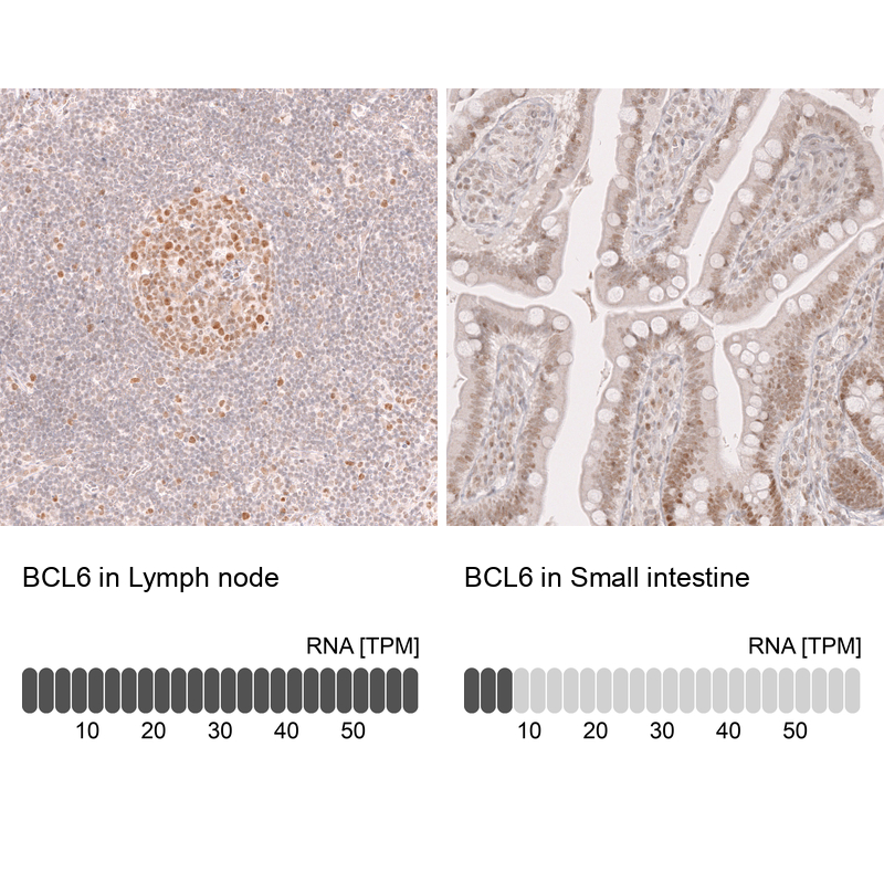 Mouse Monoclonal Anti-BCL6 Antibody - Buy for research - Highly ...