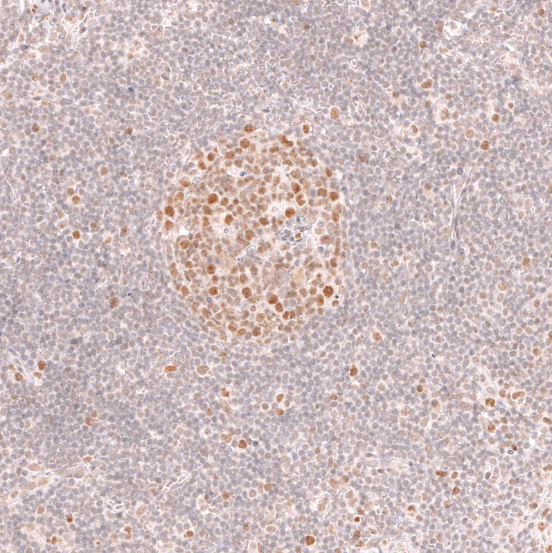 Mouse Monoclonal Anti-BCL6 Antibody - Buy for research - Highly ...