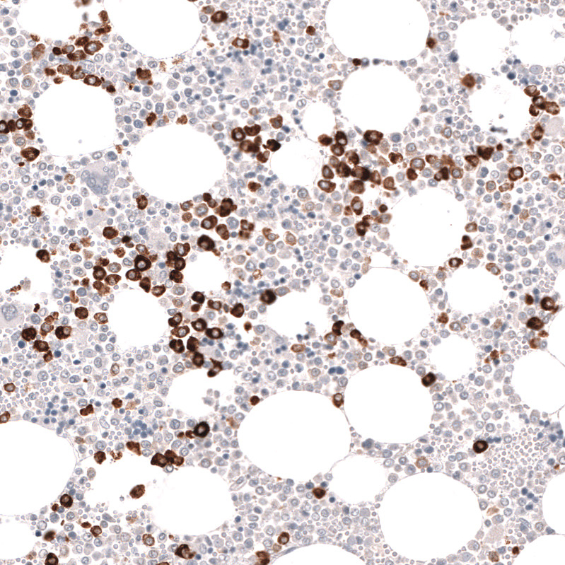 Mouse Monoclonal Anti-MPO Antibody - Buy for research - Highly specific ...