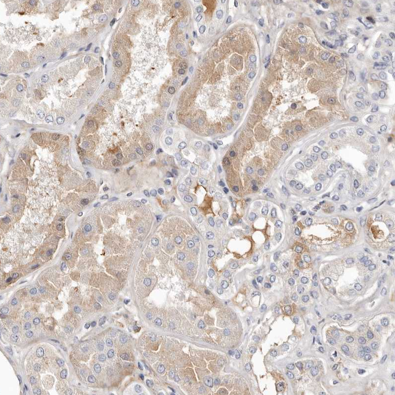 Rabbit Polyclonal Anti-LMLN Antibody - Buy for research - Highly ...