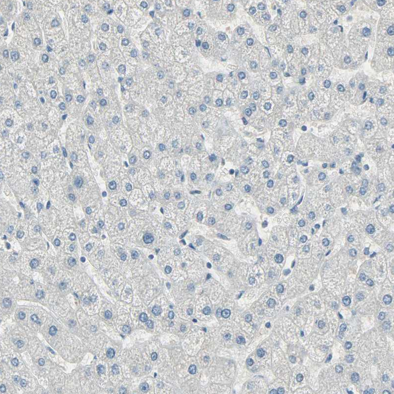 Rabbit Polyclonal Anti-PRMT5 Antibody - Buy for research - Highly ...