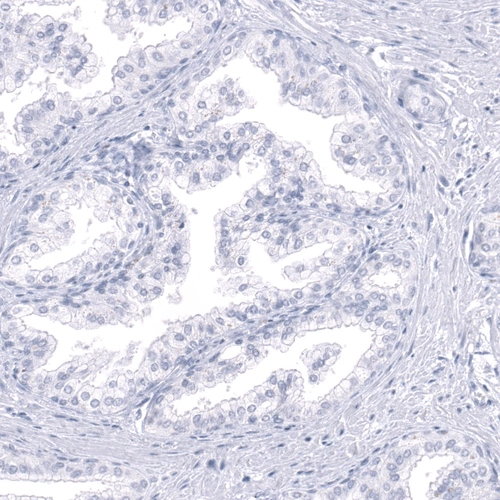 Anti-CALB1 Monoclonal Atlas Antibody