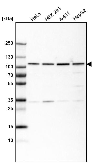 Mouse Monoclonal Anti-HSP90B1 Antibody - Buy for research - Highly ...