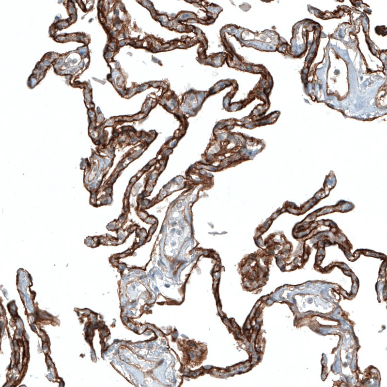 Mouse Monoclonal Anti-ITGA3 Antibody - Buy for research - Highly ...